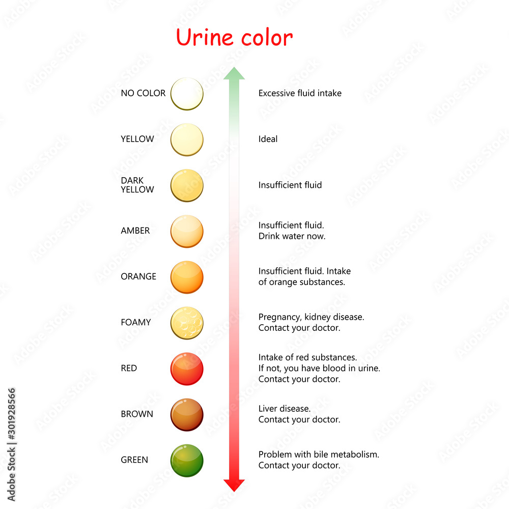Urine Color. Chart for Assessing hydration and dehydration Stock Vector ...