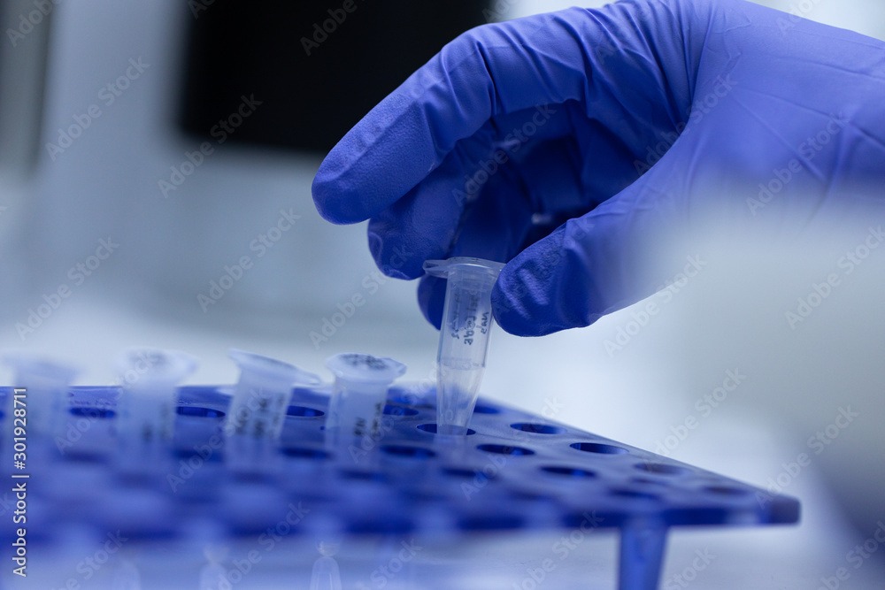 Polymerase Chain Reaction (PCR) and Agarose gel electrophoresis is a ...