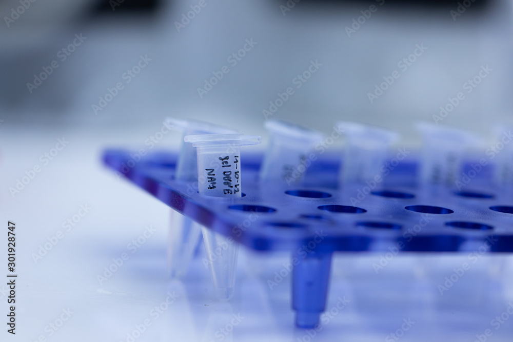 Polymerase Chain Reaction (PCR) and Agarose gel electrophoresis is a ...