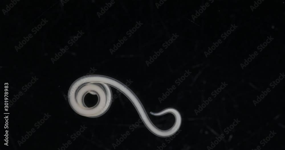 Ascariasis is a disease caused by the parasitic roundworm Ascaris ...