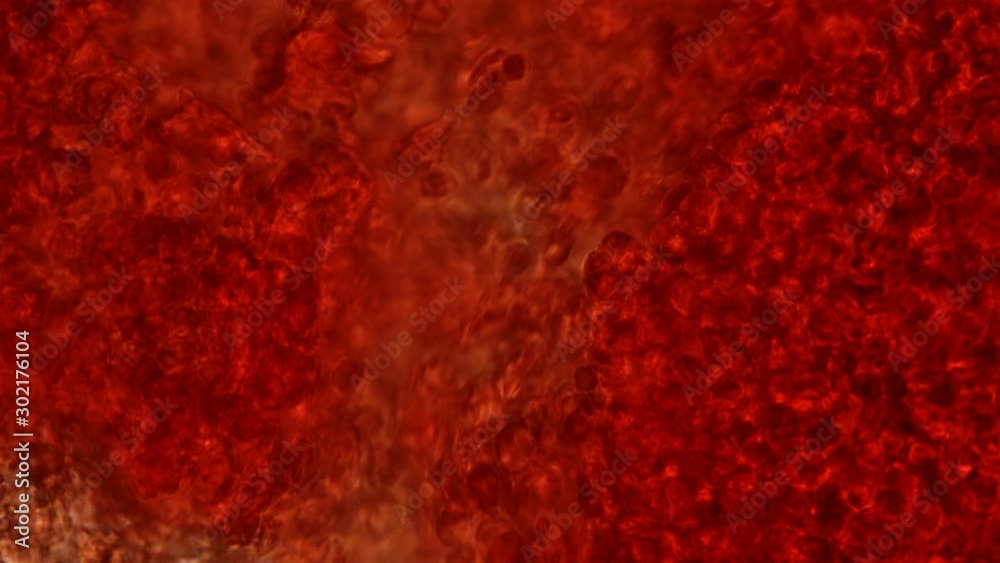 Blood under the microscope, the rapid movement of red blood cells in ...