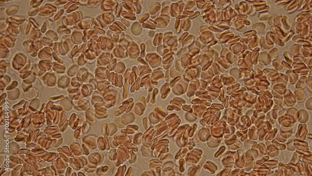 Blood under the microscope, the rapid movement of red blood cells in ...