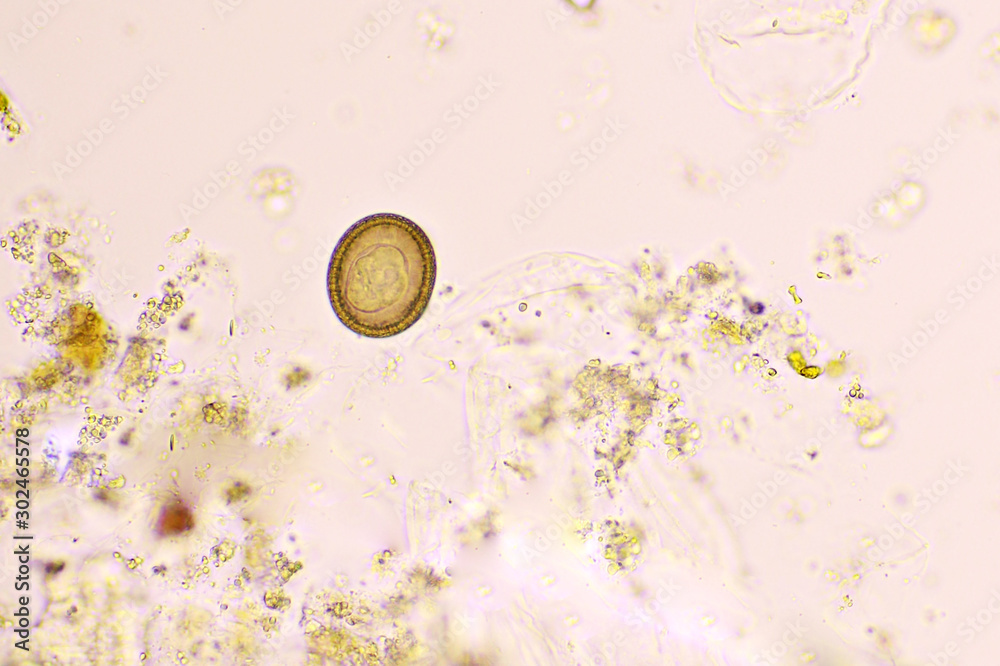 Eggs of Taenia or tapeworm in stool, analyze by microscope, original ...