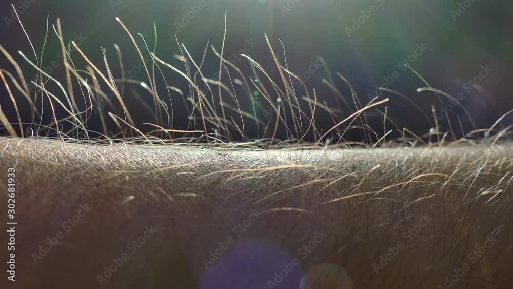 Goosebumps close up. Hair on his hand stand up. Static electricity ...