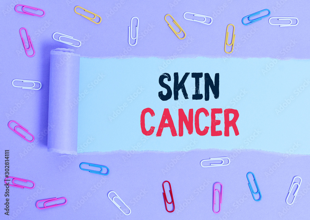 Conceptual hand writing showing Skin Cancer. Concept meaning ...