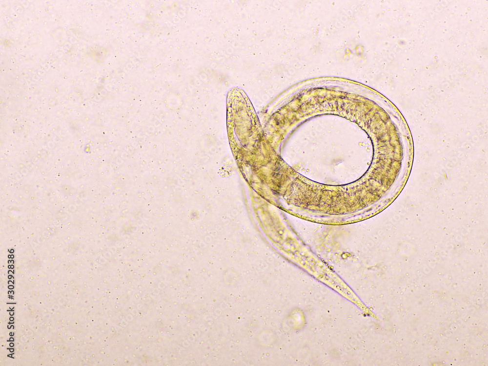 Strongyloides stercoralis or threadworm in human stool, analyze by ...