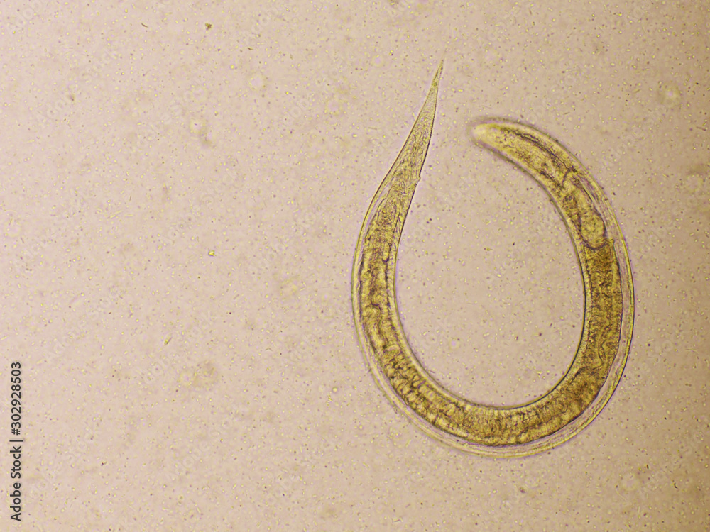 Strongyloides stercoralis or threadworm in human stool, analyze by ...