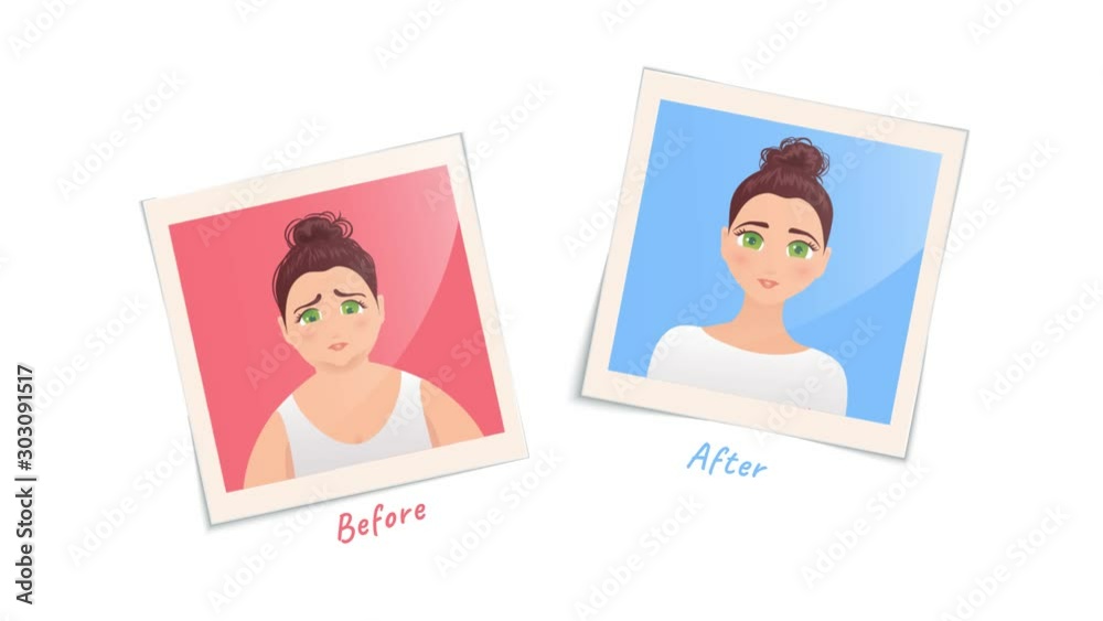 Cartoon animation of two photographs of a woman before and after weight ...