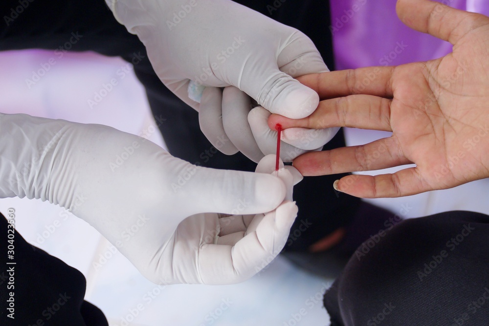 Capillary Collection Procedure