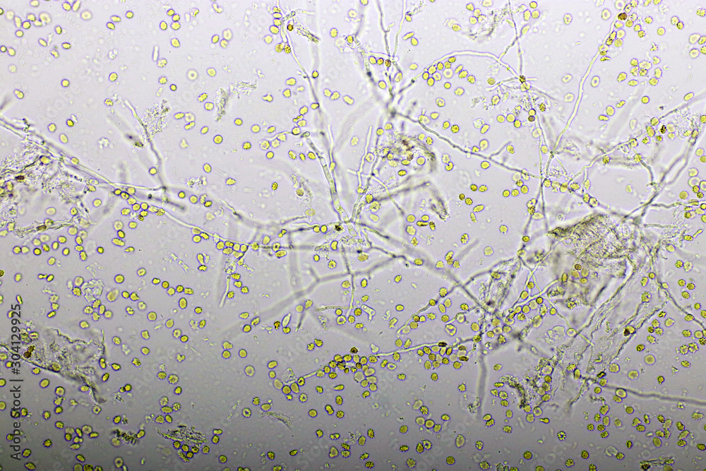 Yeast Under Microscope 400x