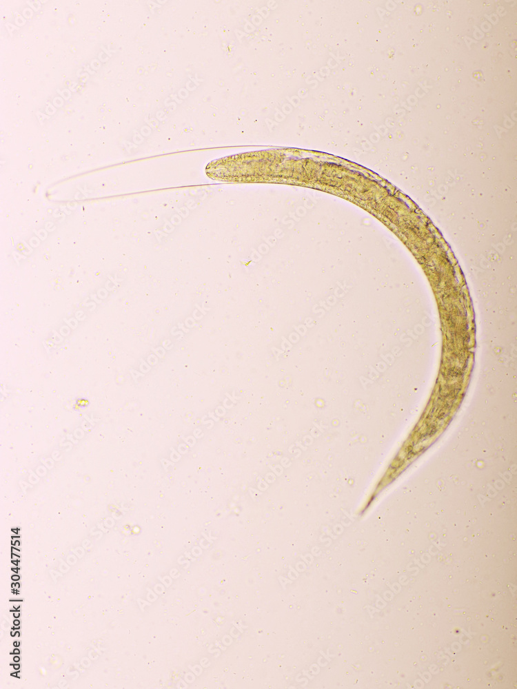 Strongyloides stercoralis or threadworm in human stool, analyze by ...