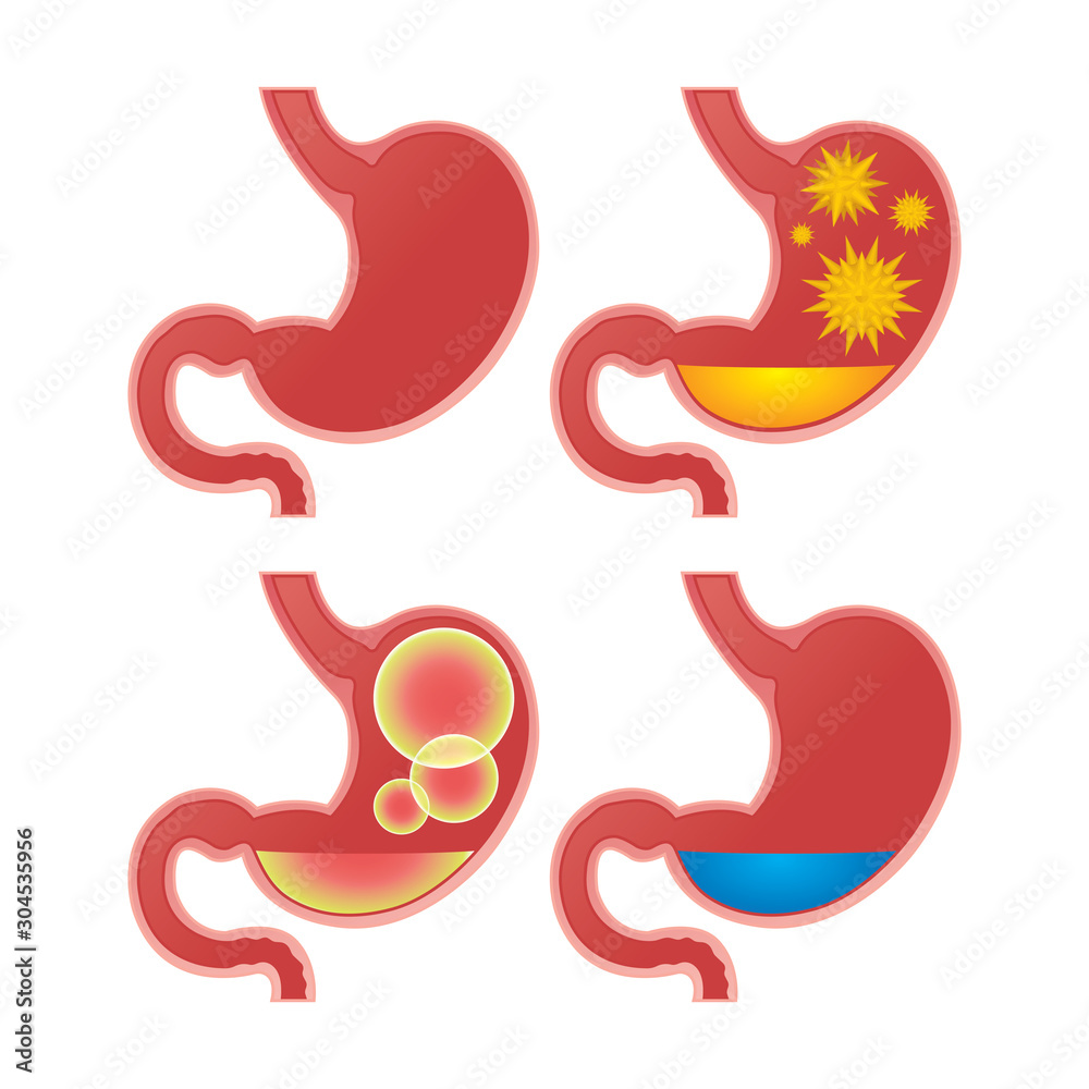 Empty Stomach Pain