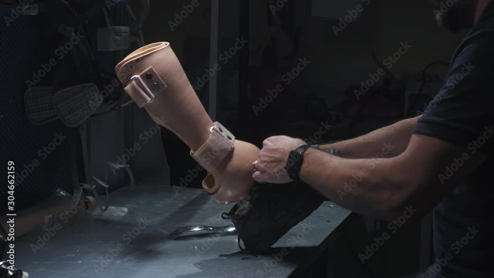 An engineer puts on sneakers on a prosthetic leg. Inserts the ...