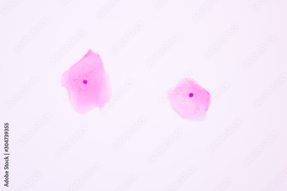 View In Microscopic Of Normal Human Cervix Cellssquamous Epithelium