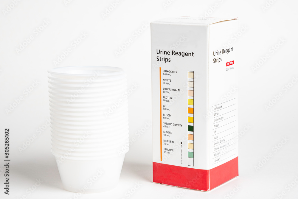 Urine Strips Box And A Stack Of Plastic Containers Stock Photo | Adobe ...