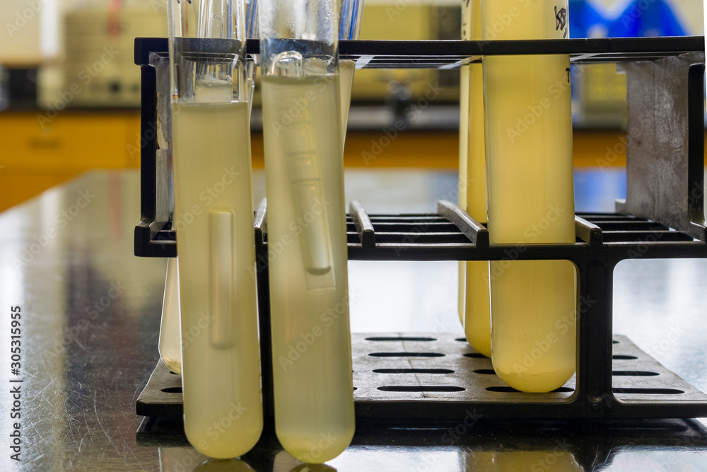 Foto de Durham tubes showing gas production by bacteria. This is a ...