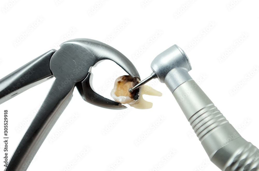 dental forceps and dental turbine tip decide to treat or remove tooth ...