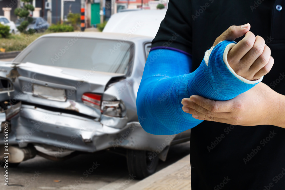 Man holding hand with blue bandage as arm injury with car accident ...