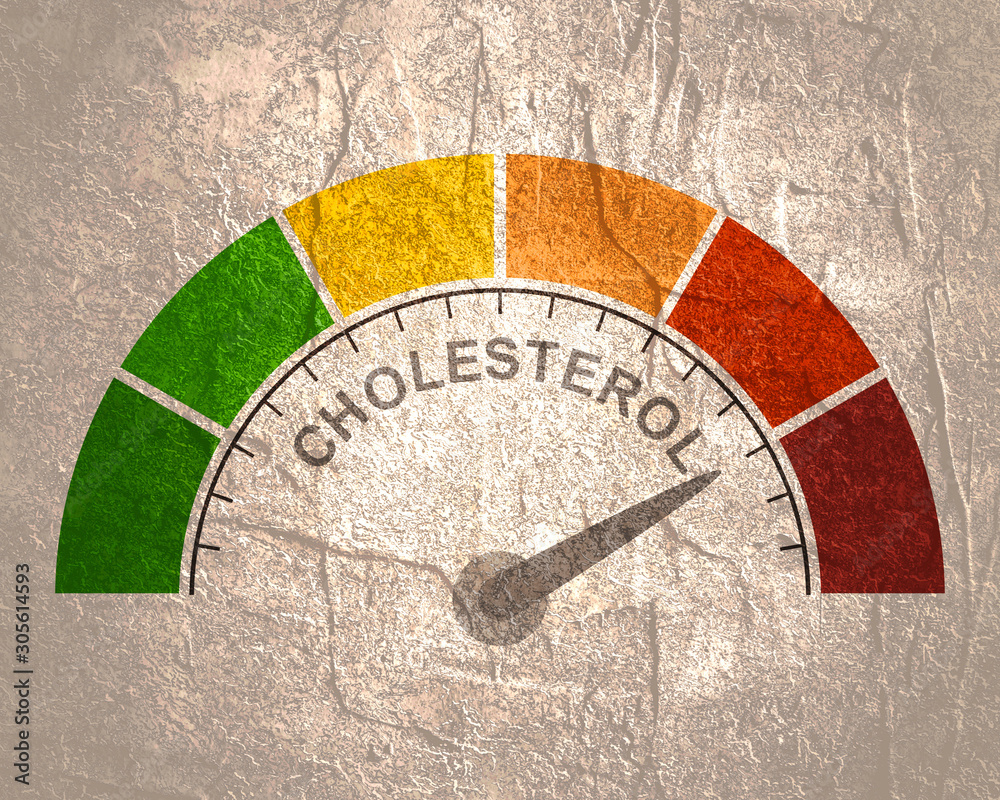 Cholesterol meter read high level result. Color scale with arrow from ...