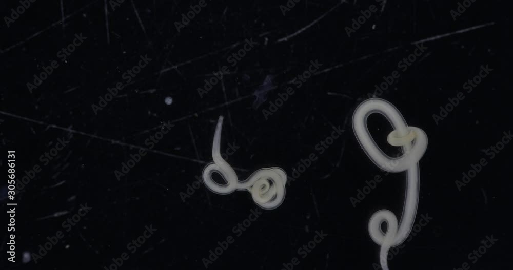 Study Ascarid nematode of the phylum Nematoda, it is the most common ...