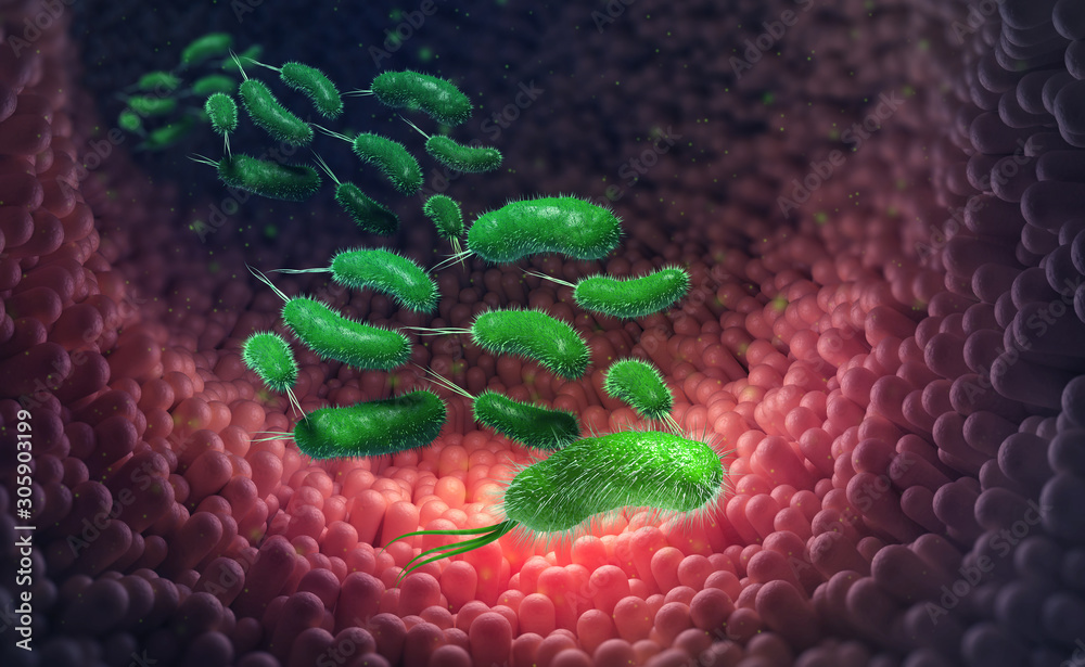 Escherichia coli, germs and viruses in body. Bowel infection, upset ...