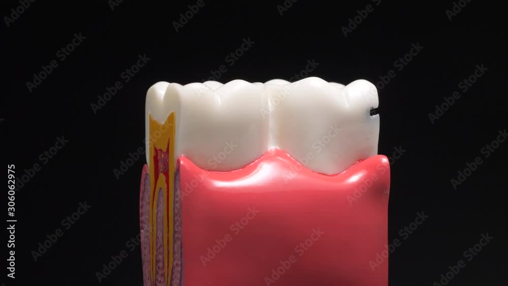 Anatomy plastic model showing the inside of a human tooth. On one side ...