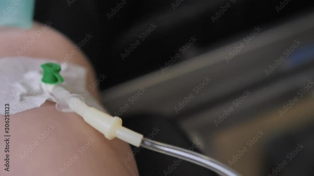 Pulse oximeter on the finger of the patient. A peripheral venous ...