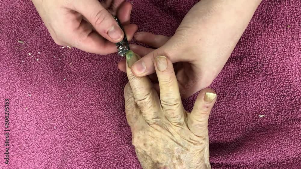 Clipping cutting fingernail of senior woman by young caregiver with ...