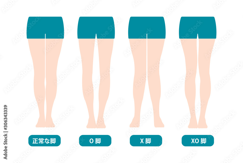 Difference types of legs angles and knees vector illustration (Japanese ...