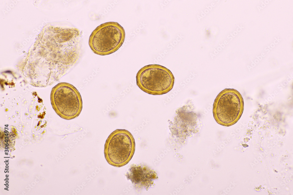 Egg of Ascaris lumbricoides (roundworm) in stool, analyze by microscope Stock Photo | Adobe Stock