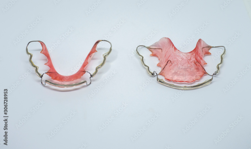pink hawley retainers on isolate white background Stock Photo | Adobe Stock