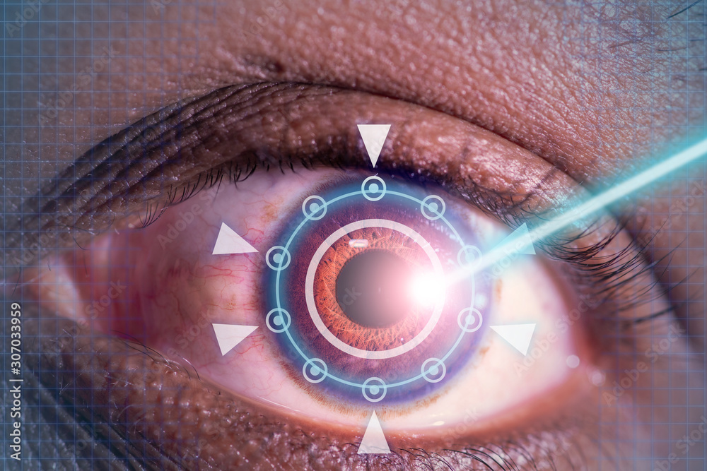 laser or lasik eye surgery concept, l laser beam shining into african ...