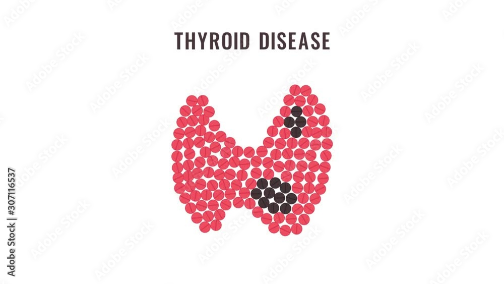 Thyroid disease cartoon animation of pills forming thyroid gland ...