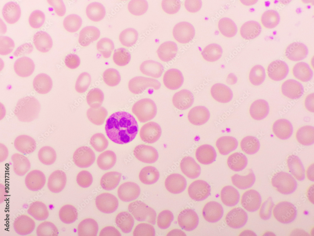 Neutrophil cell in blood smear, analyze by microscope, 1000x Stock ...