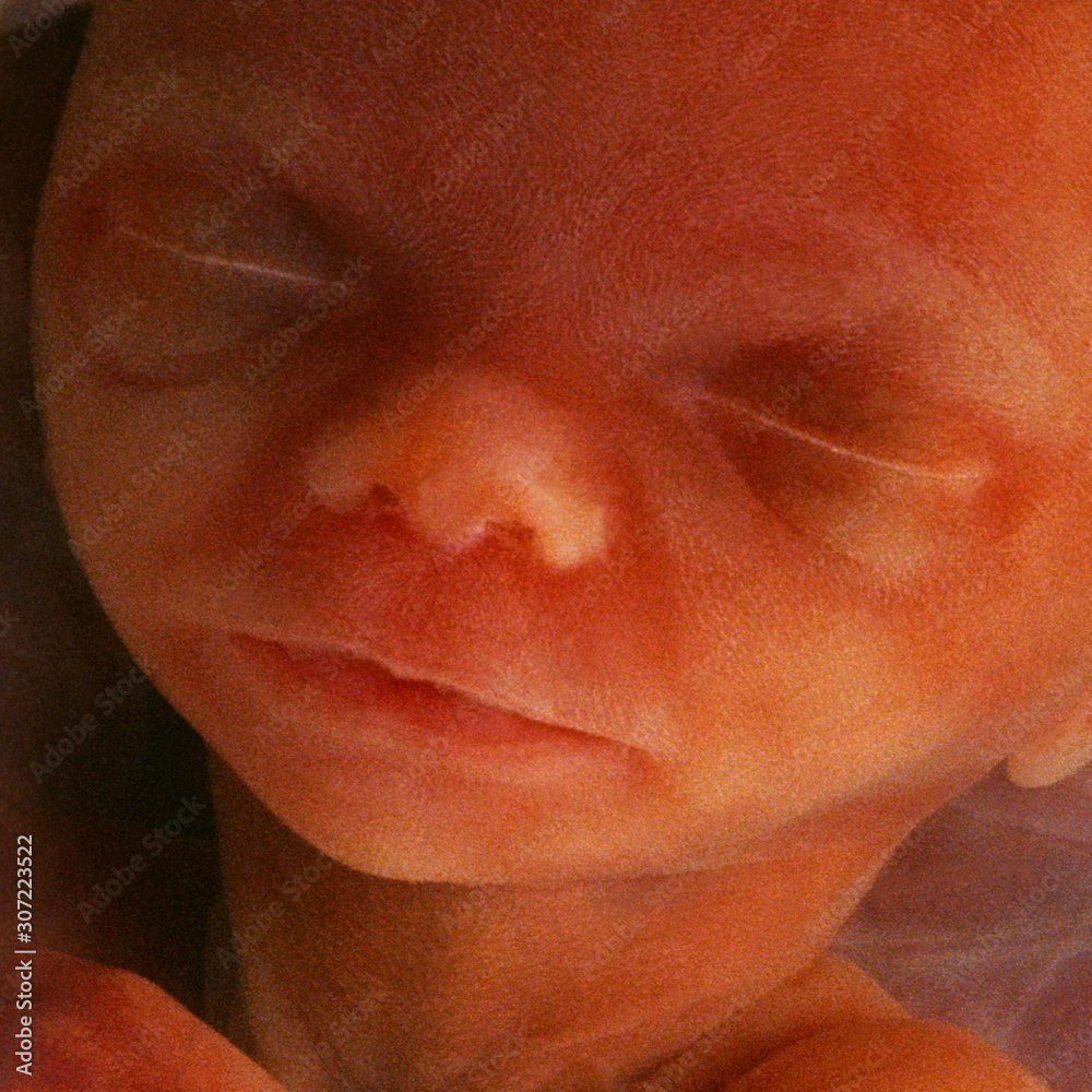 In vitro image of a human fetus in the womb Stock 写真 | Adobe Stock