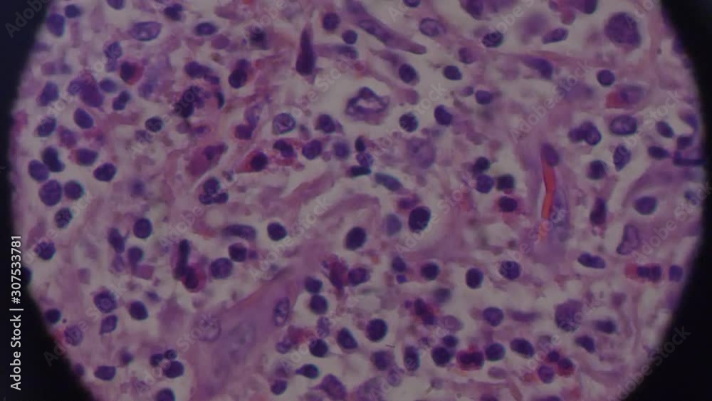 cells seen through a microscope 4k Stock Video | Adobe Stock