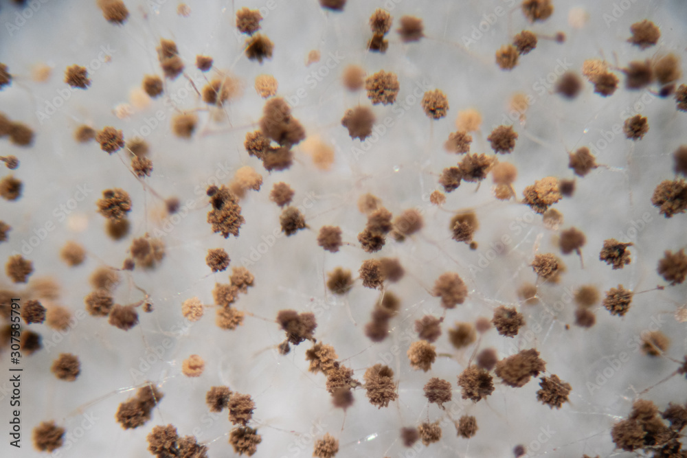 Rhizopus (bread mold) is a genus of common saprophytic fungi,Rhizopus ...