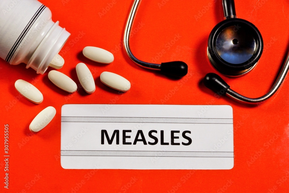 Measles is an infectious viral disease. with high fever, inflammation ...