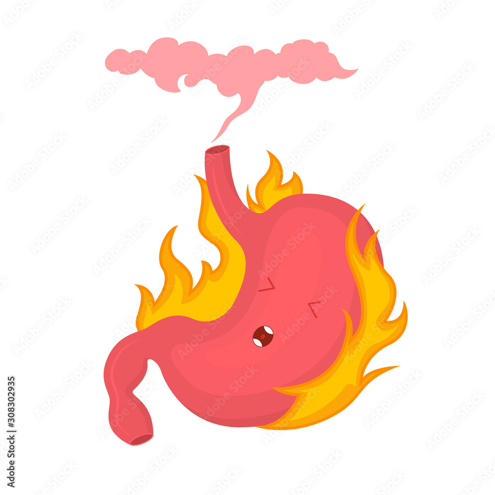 Cartoon Color Character Acid Reflux or Heartburn Concept. Vector Stock ...