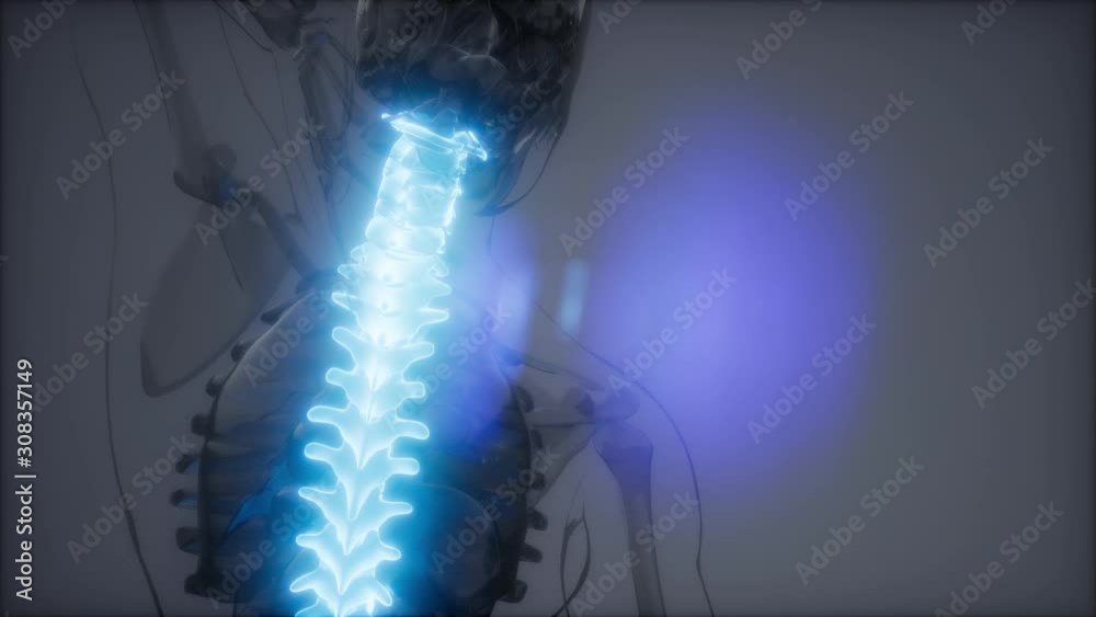 backache in backbone. science anatomy scan of human spine bones glowing ...