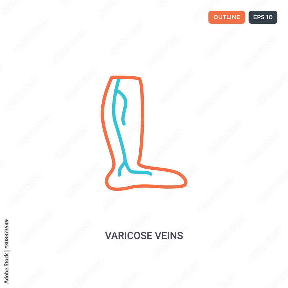 2 color Varicose veins concept line vector icon. isolated two colored ...