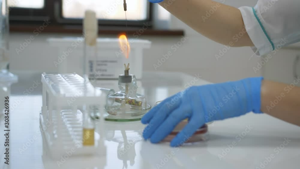 Bacteriological crops of various bacteria and microorganisms are ...