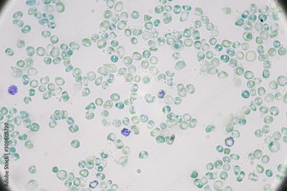 Red blood cells (Polychromasia) Stock Photo | Adobe Stock