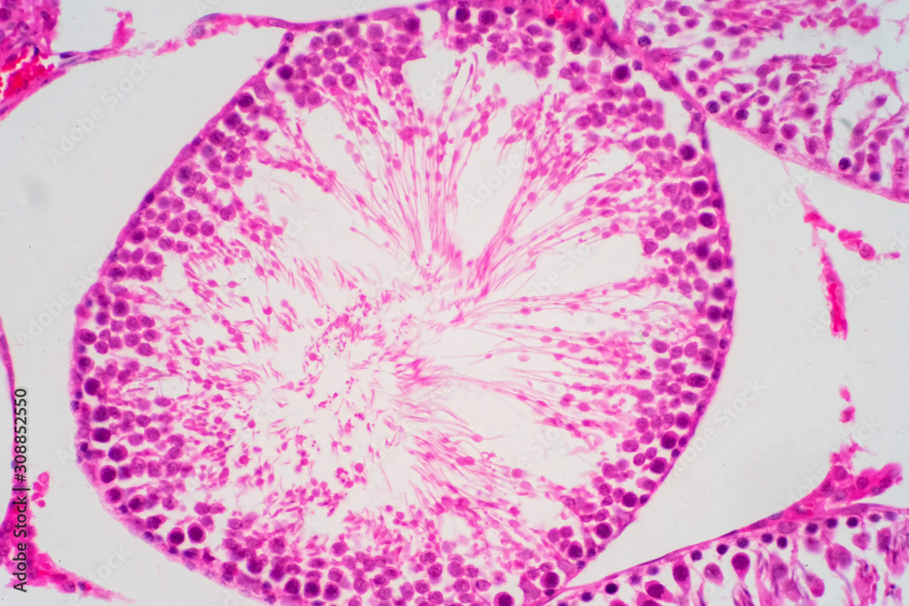 Human sperm in the testis morphology under microscope. Stock Photo ...