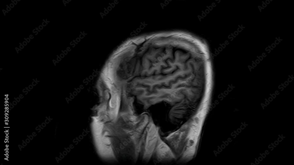 Brain MRI, head scans and tumor detection. Diagnostic medical tool ...