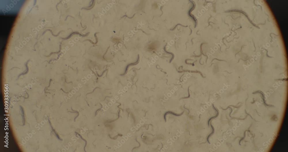 A colony of microorganisms, c-elegans (Caenorhabditis elegans) nematode worms under the ...