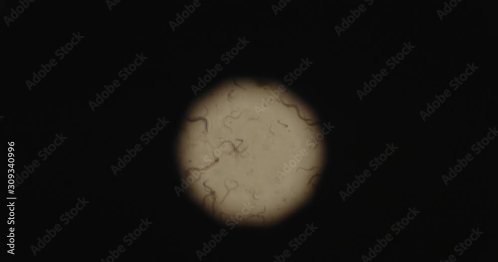 Shutter of a lens opening and revealing a colony of microorganisms, c ...