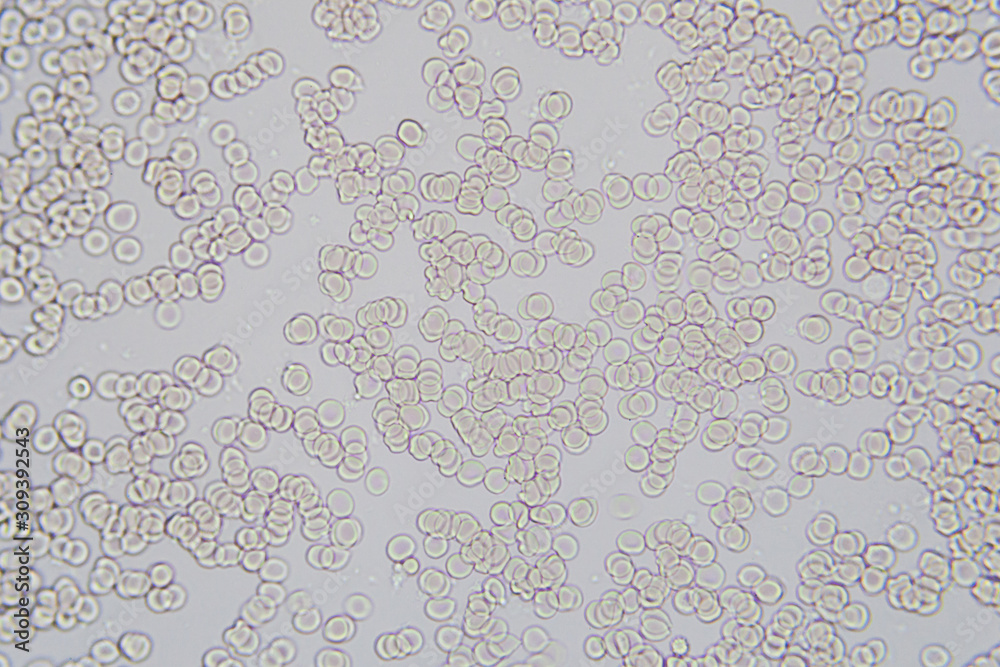 Blood cells microscopic image magnification x 400 foto de Stock | Adobe ...