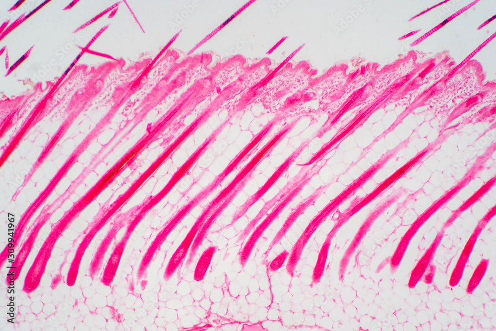 Cross section human skin head under microscope view for education ...