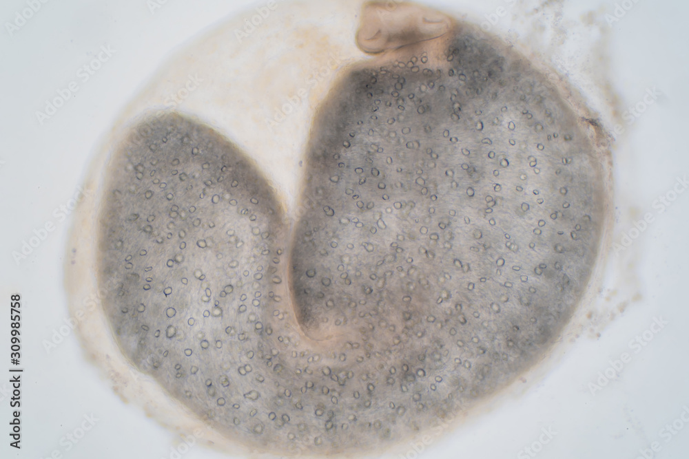 Eggs liver fluke(Parasitic flatworm) under microscope view for ...